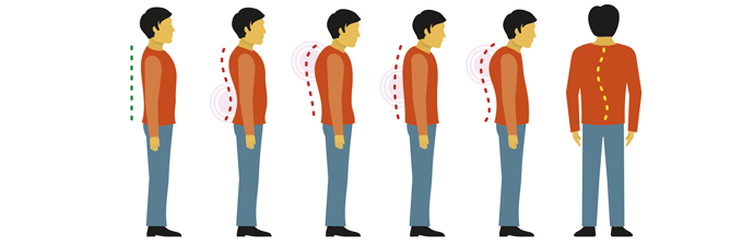 Retificação da Coluna: como tratar com o Método Pilates? - Blog Pilates ...