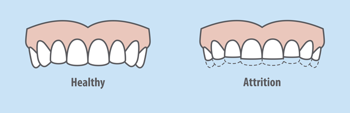Pilates no Alívio da Sintomatologia de Disfunção Temporomandibular