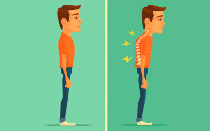 Arquivos exercícios para hipercifose torácica - Blog Pilates - O maior ...